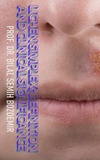 Lichen Simplex; Definition and Clinical Significance (Book) | eBooks